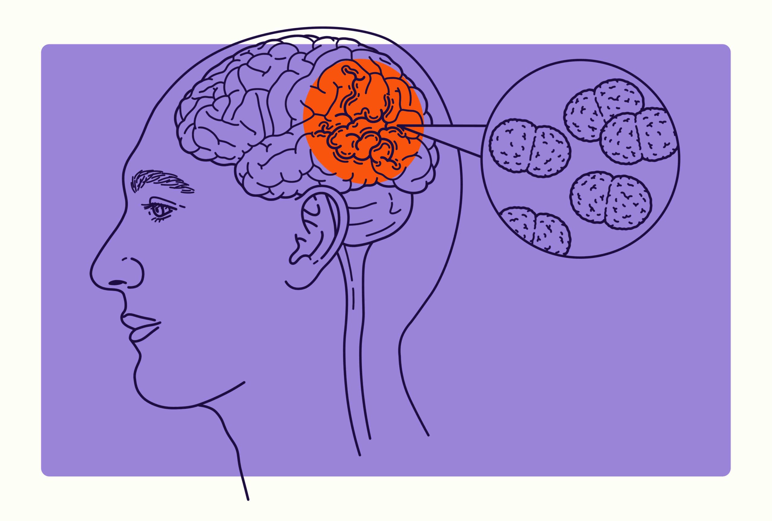 Meningitis: Mengenali Gejala dan Strategi Pengobatan yang Efektif - eSatuID