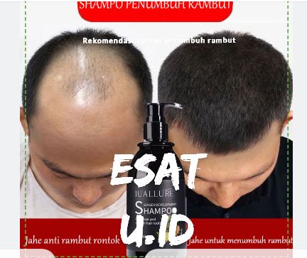 3 Rekomendasi Sampo Penumbuh Rambut,Yang wajib Kalian Tahu.