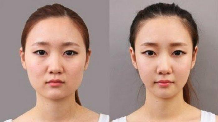 7 Rahasia Pipi Tirus Tips dan Trik untuk Mencapai Wajah yang Lebih ...
