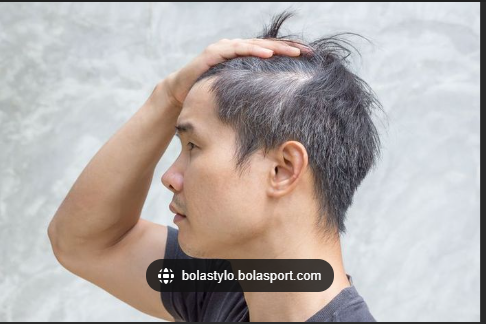 Kenalin Yuk 6 Penyebab Rambut Uban Di Usia Muda